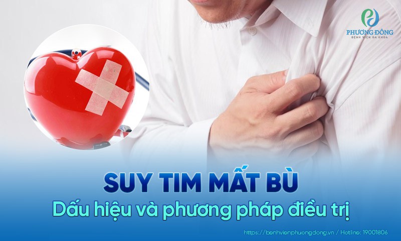 Suy tim mất bù là gì? Nguyên nhân và hướng điều trị hiệu quả