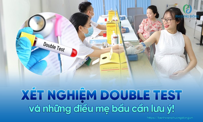 Xét nghiệm Double test là gì? Cần chuẩn bị gì để cho kết quả chính xác?