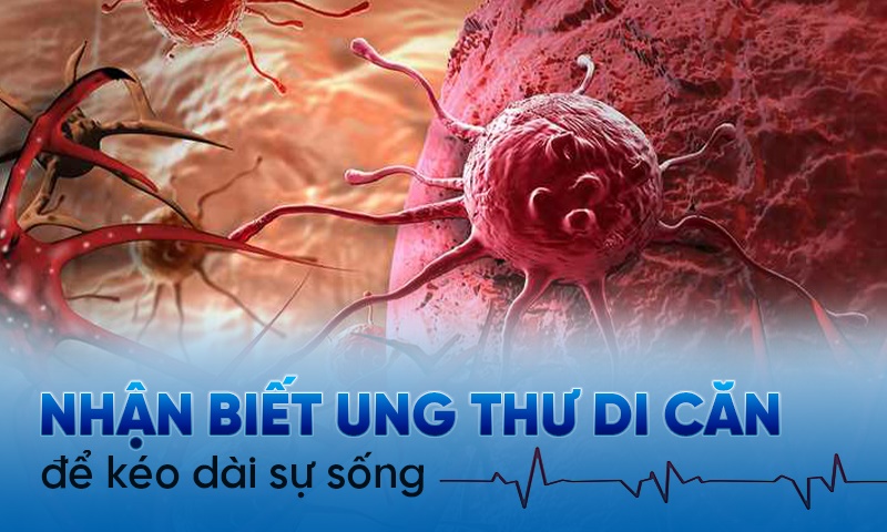 Ung thư di căn là gì? Các triệu chứng và cách điều trị bệnh
