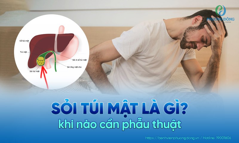 Sỏi túi mật là gì? Nguyên nhân và phương pháp phòng bệnh
