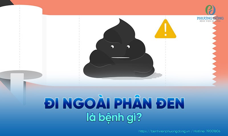 Đi ngoài phân đen là bệnh gì? Liệu có phải là dấu hiệu cảnh báo nguy hiểm?