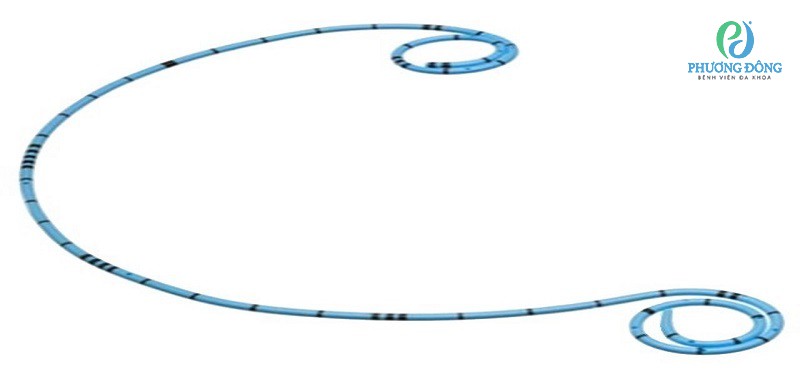 Đặt ống sonde JJ niệu quản là gì & các bước tiến hành đặt sonde JJ