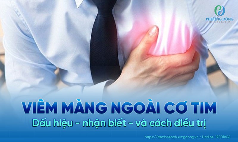 Viêm màng ngoài tim và một số vấn đề cần phải lưu ý