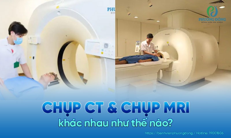 Hỏi đáp về chụp MRI và chụp CT: Mục đích, lợi ích và nguy cơ