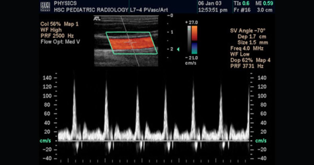 Siêu âm Doppler: Vai trò, ứng dụng và quy trình thực hiện