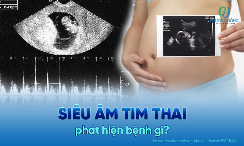 Siêu âm tim thai: Đối tượng, thời gian, ý nghĩa và kỹ thuật thực hiện