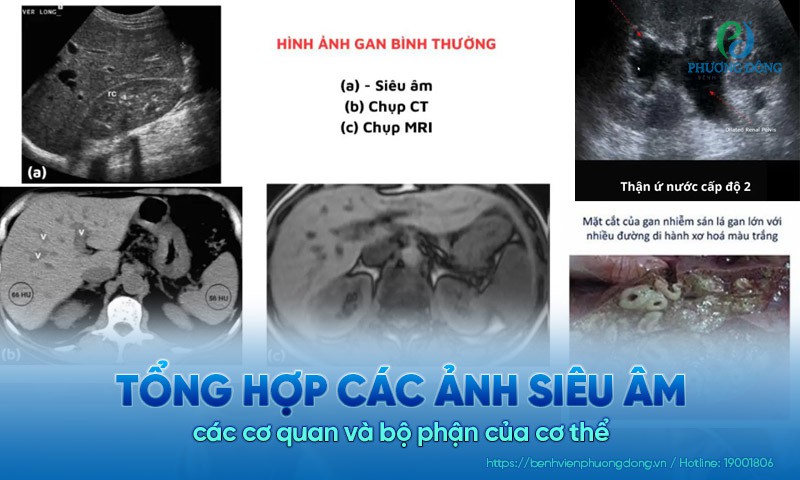 50+ hình ảnh siêu âm các cơ quan và bộ phận của cơ thể